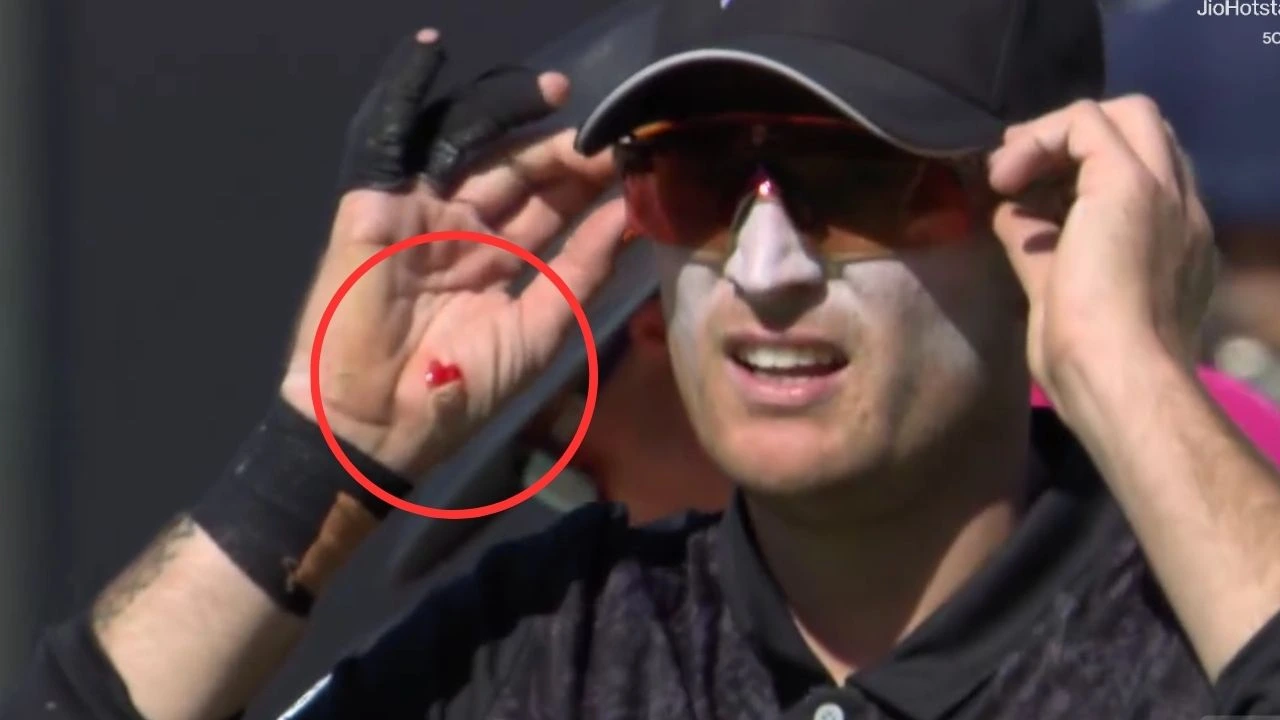 Jayden Lennox walks off BLEEDING after taking Virat Kohli's bullet in ...